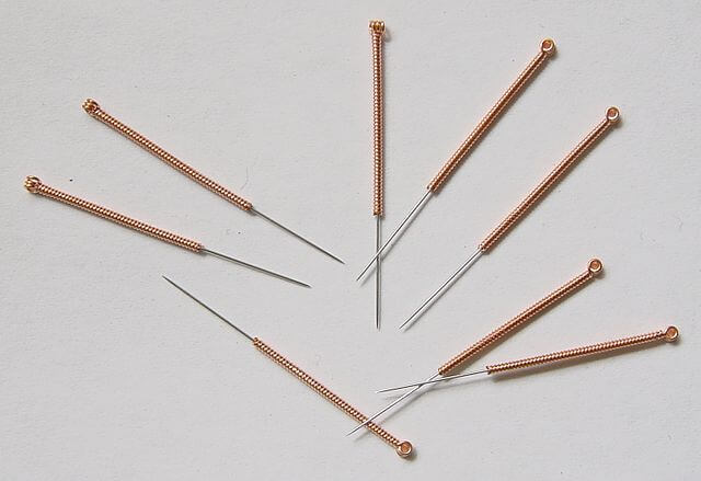 10 Astounding Acupuncture Facts